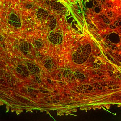 Unique Microscope Installed in the Technology Building | UiT